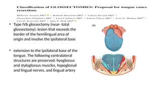 GLOSSECTOMY AND RECONSTRYCTION HEAD AND NECK CANCER | PPTX