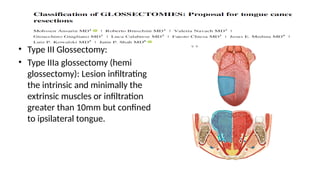 GLOSSECTOMY AND RECONSTRYCTION HEAD AND NECK CANCER | PPTX