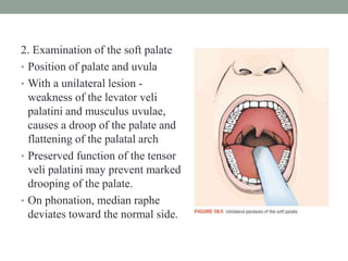 Glossopharyngeal (cn ix) and vagus ( | PPT