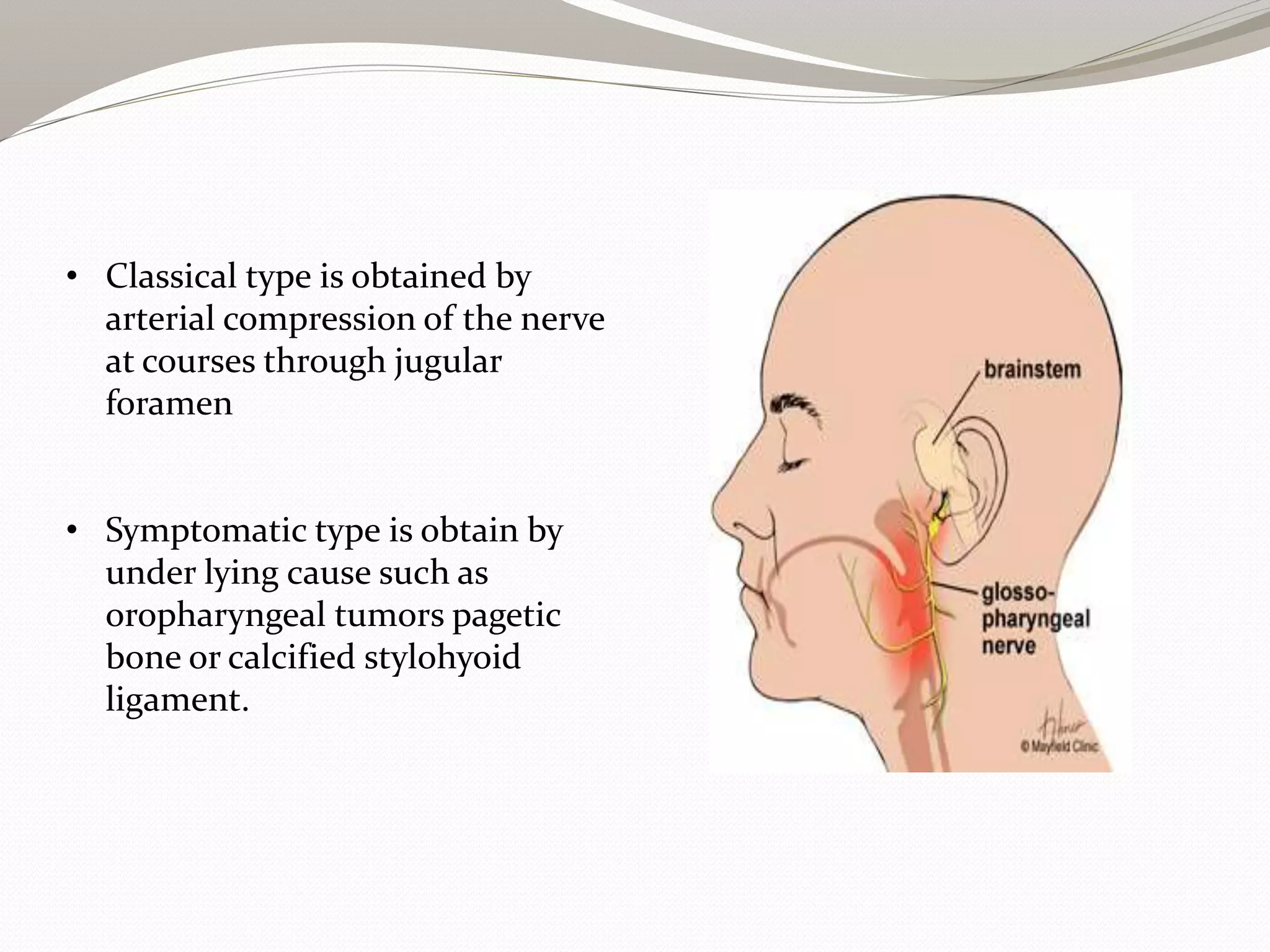Glossopharyngeal nerve & its pathology ppt | PPTX
