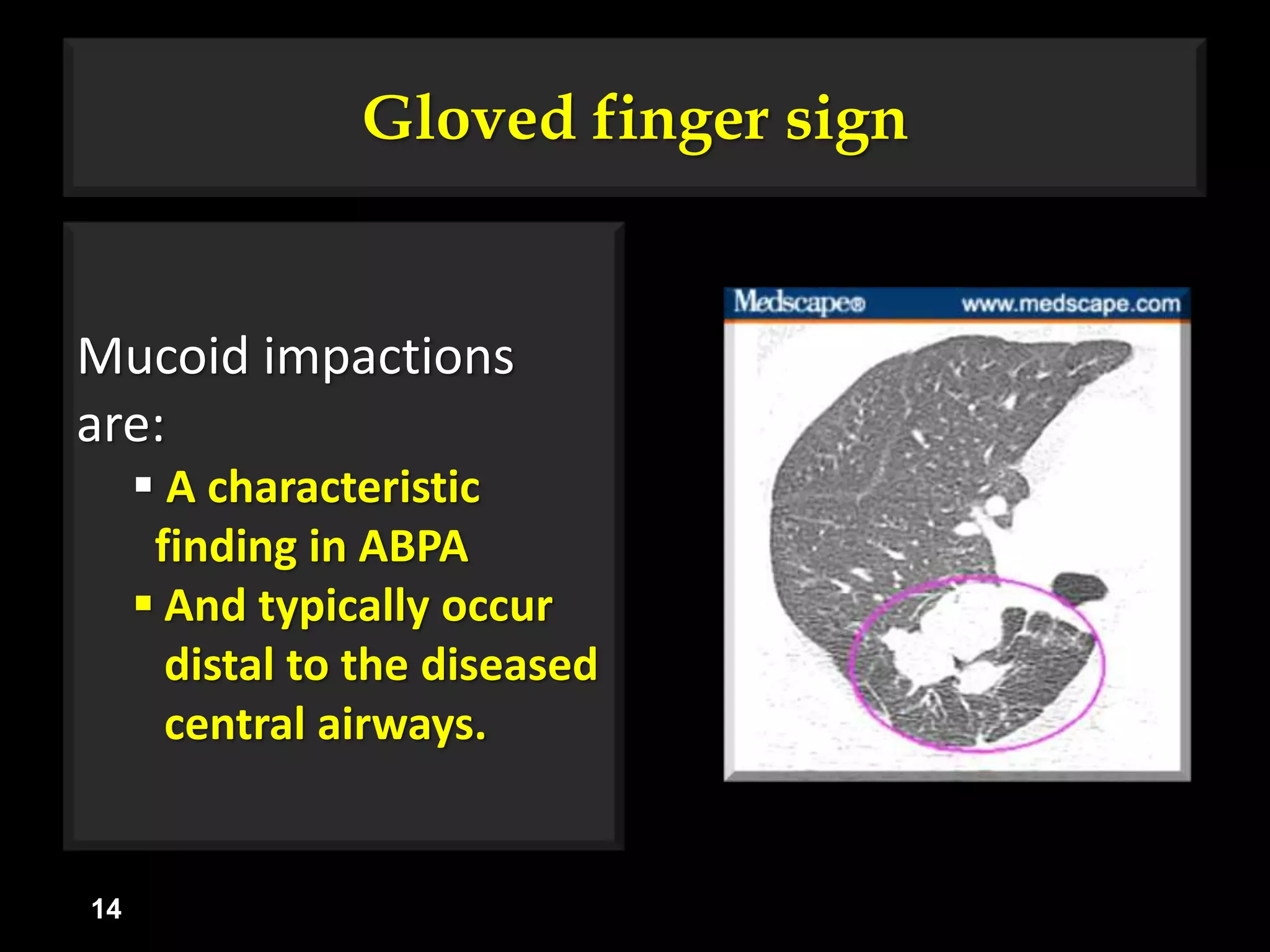 Gloved finger sign and cervicothoracic sign | PPTX