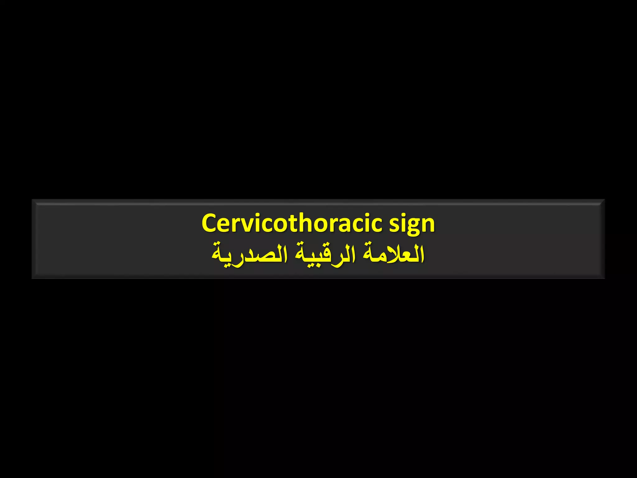 Gloved finger sign and cervicothoracic sign | PPTX