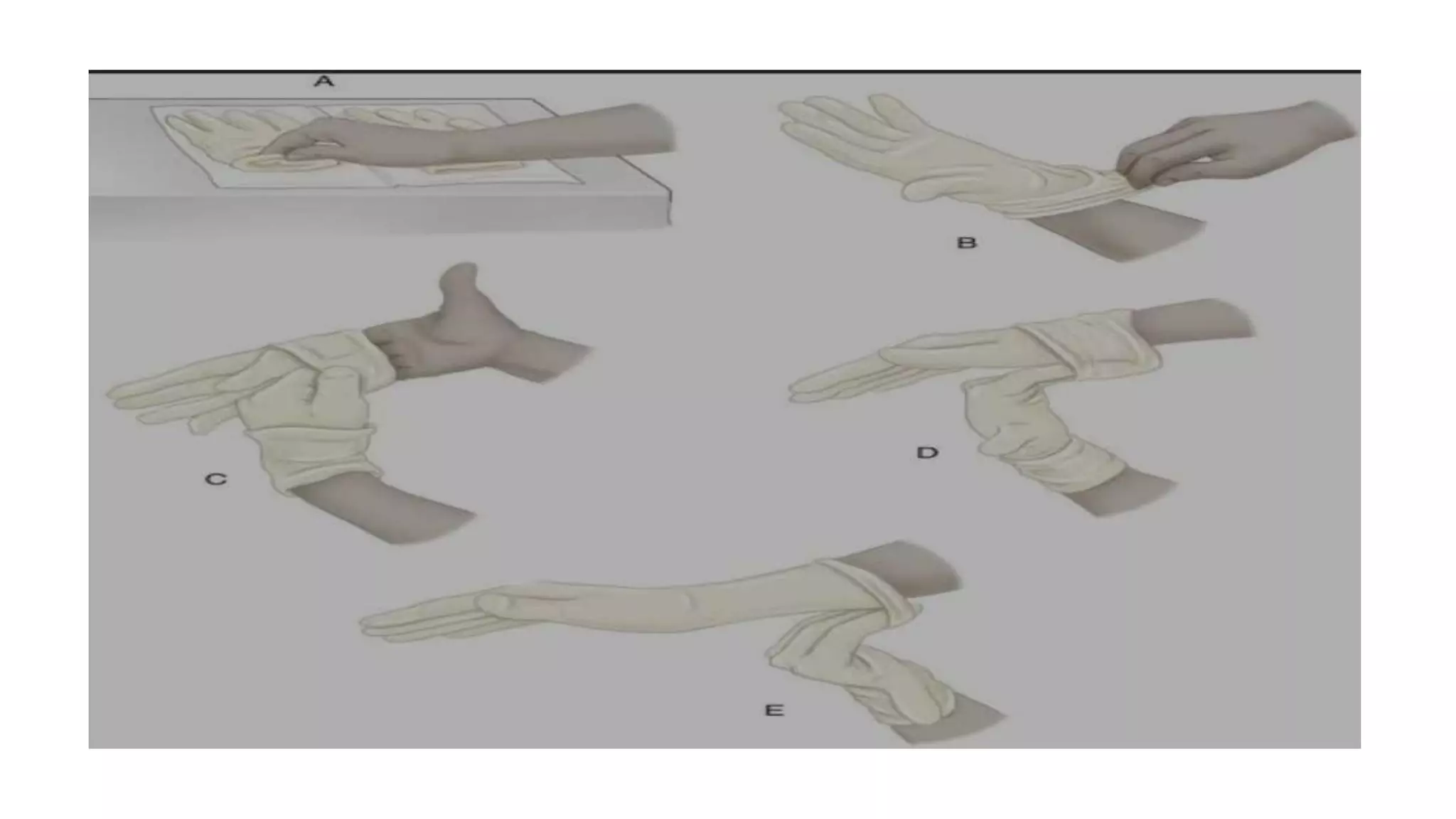 Gloving degloving | PPTX