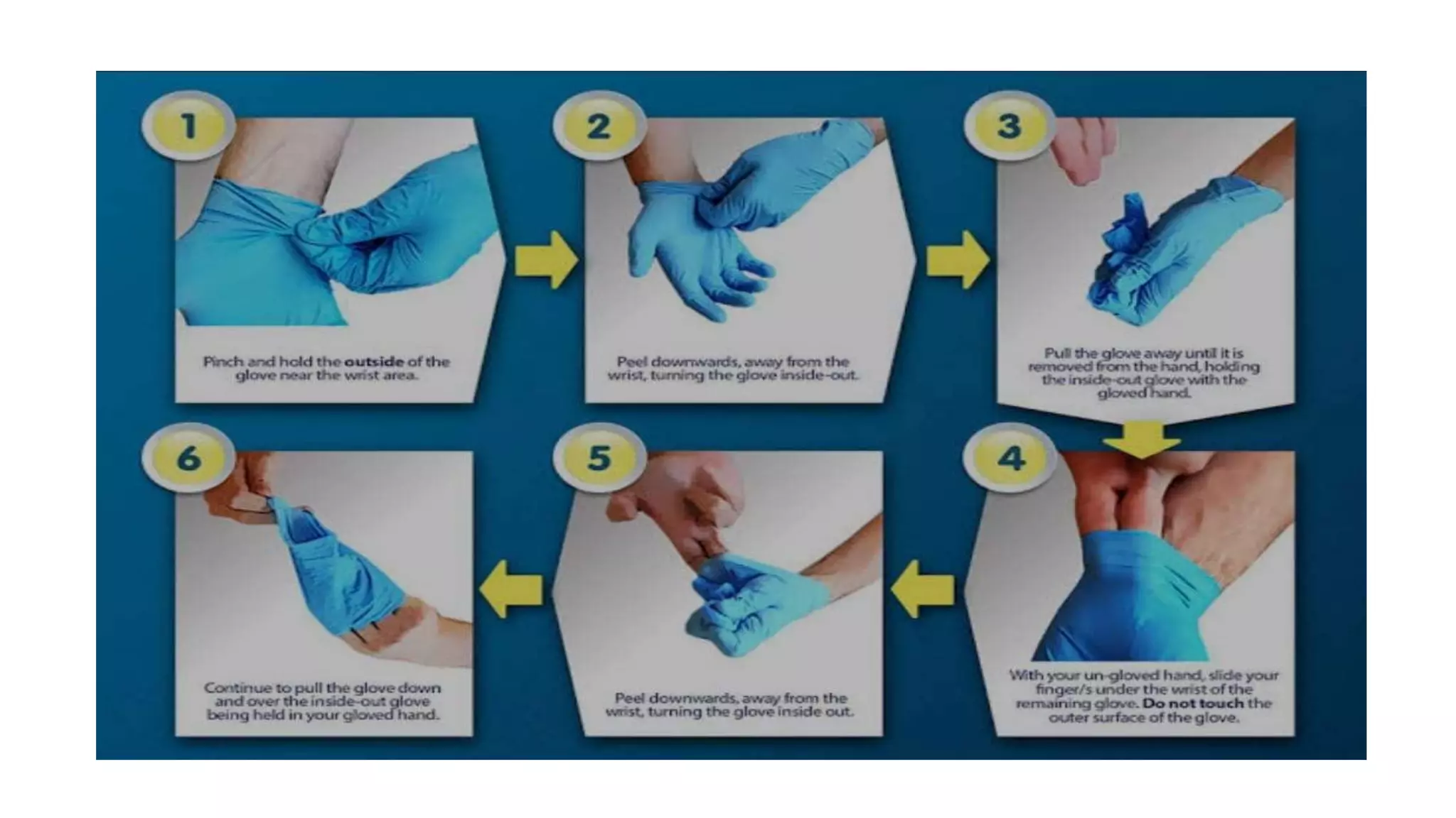 Gloving degloving | PPTX | Infectious Diseases | Diseases and Conditions