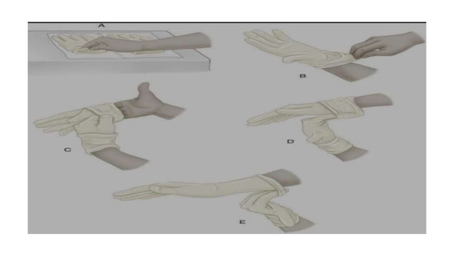 Gloving degloving | PPTX | Infectious Diseases | Diseases and Conditions