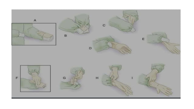 Gloving degloving | PPTX | Infectious Diseases | Diseases and Conditions