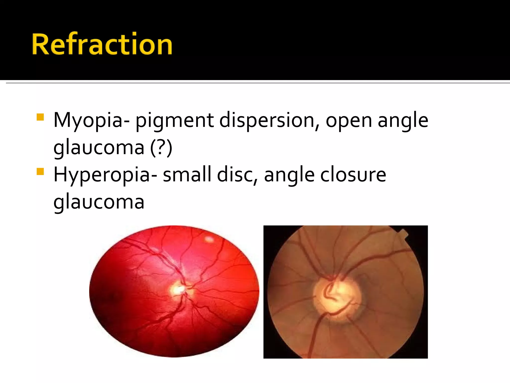 Gluacoma clinical evaluation | PPT