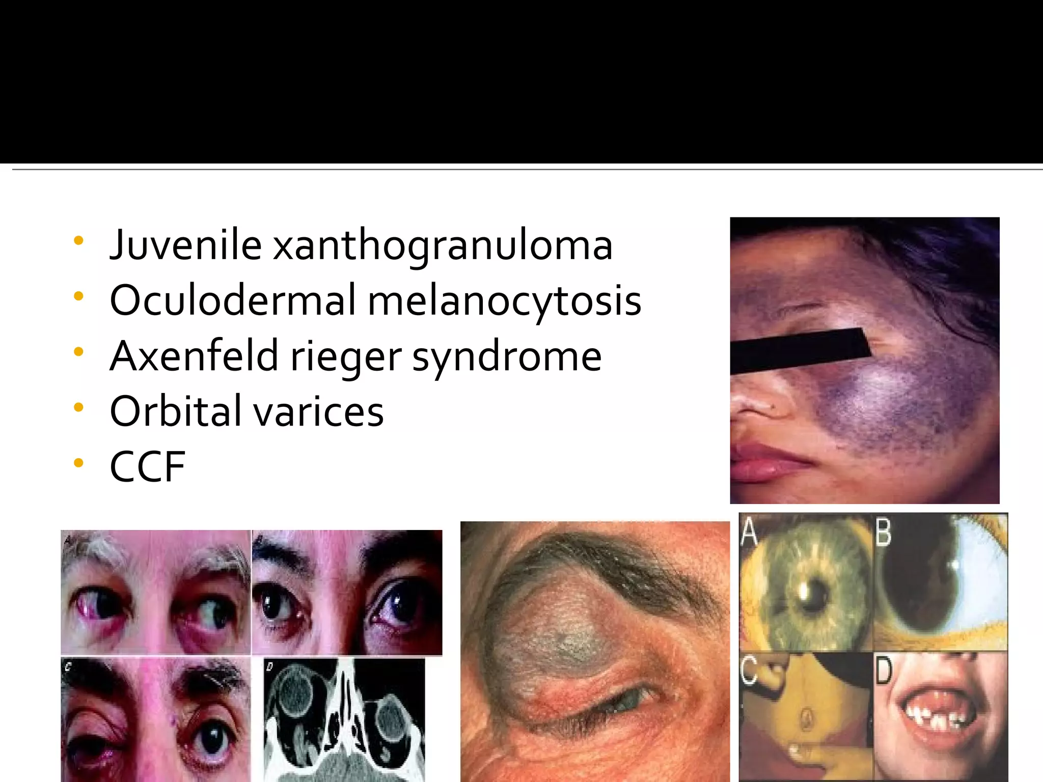 Gluacoma clinical evaluation | PPT