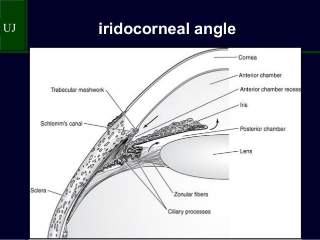 Glaucoma