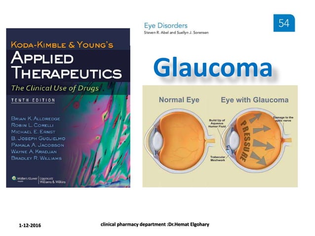 Glaucoma | PPT