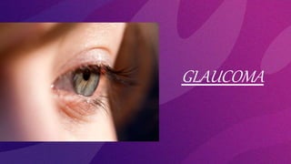 Glucoma.pptx
