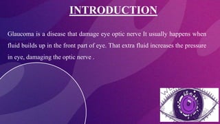 Glucoma.pptx