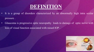 Glucoma.pptx