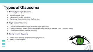 glucoma treatment mumbai | PPTX