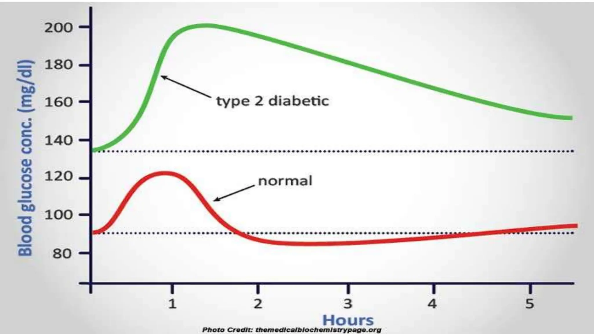 Glucose Tolerance Test.ppt