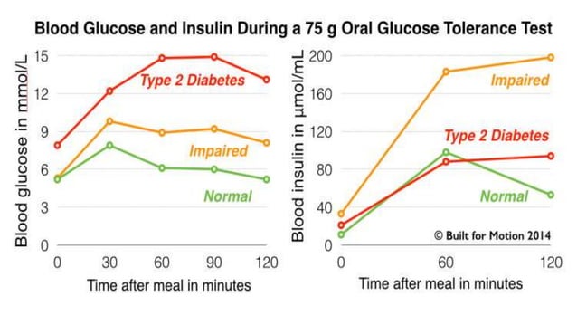 Glucose Tolerance Test.ppt | Diabetes | Diseases and Conditions