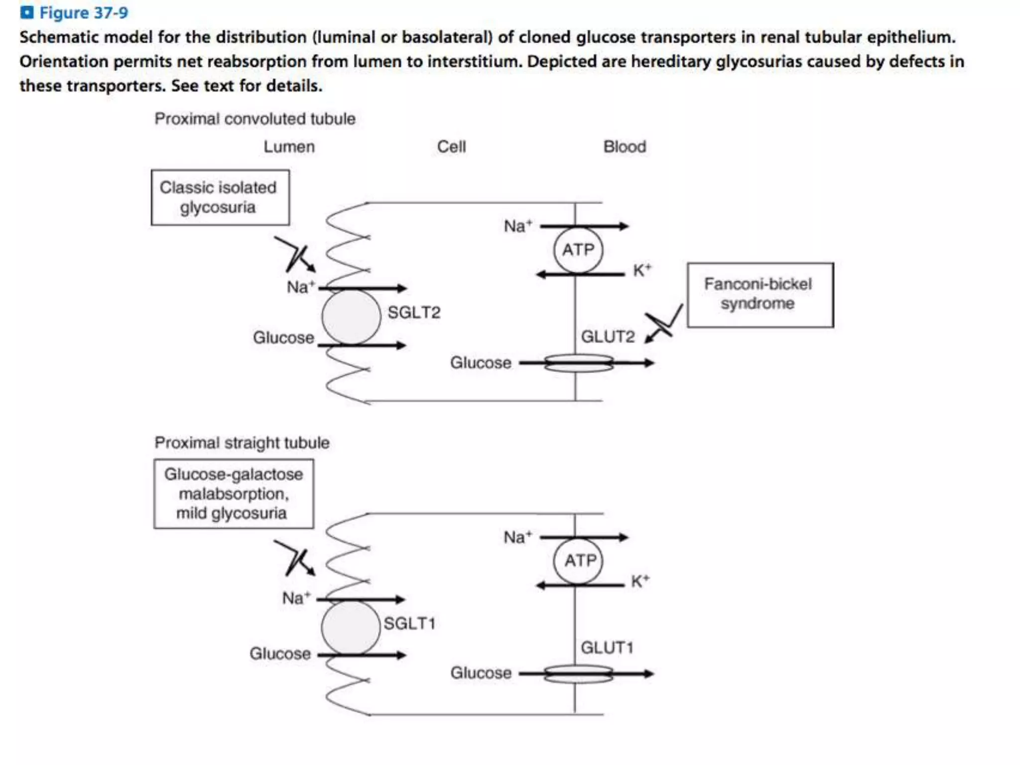 Glucosuria | PPTX