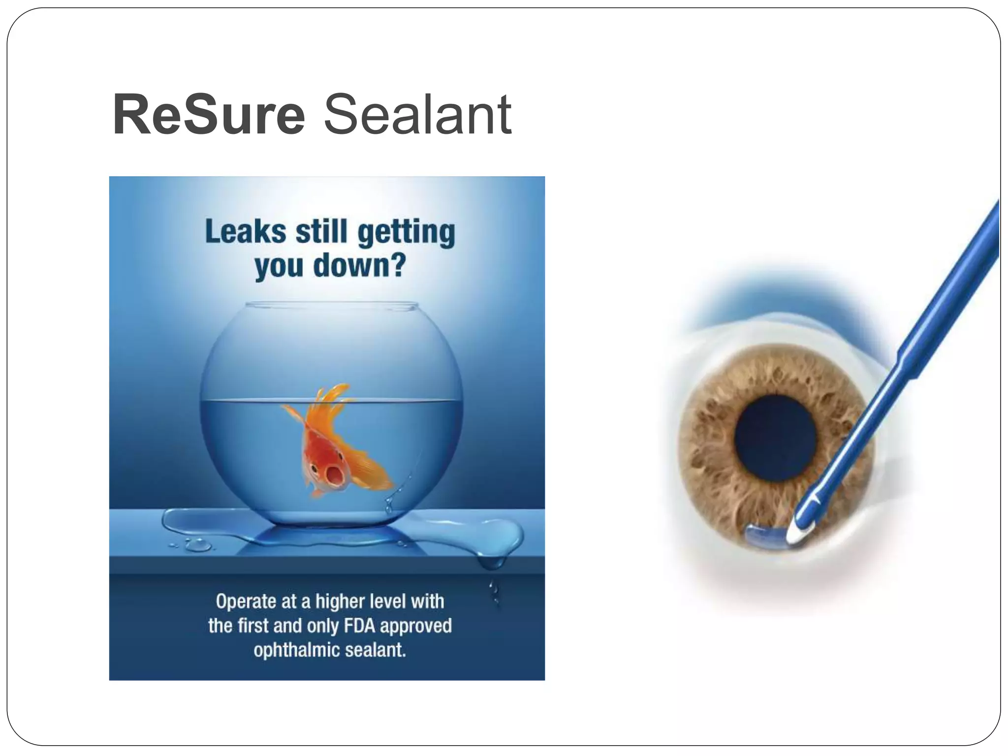 Tissue Adhesive In Ophthalmology | PPTX
