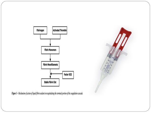 Tissue Adhesive In Ophthalmology | PPTX | Eye and Vision Conditions ...