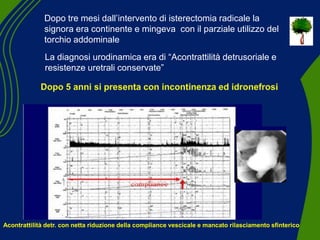 Glup montecchio filosofia urodinamica_carone | PPTX