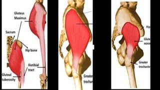Gluteal Muscles.pptx
