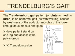 Reverse Trendelenburg Gait