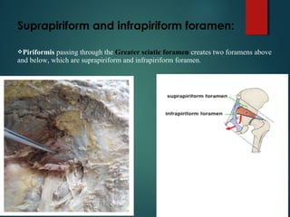 Gluteal region | PPT | Death, Injury, or Military Conflict | Sensitive ...