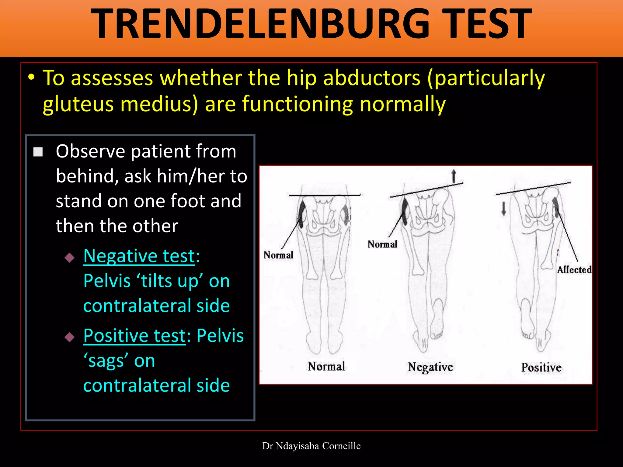 GLUTEAL REGION.ppt