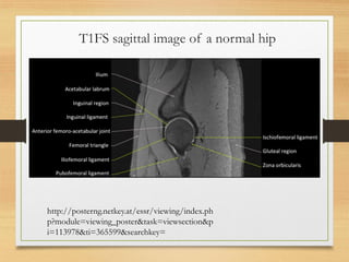 Gluteal region clinical anatomy | PDF