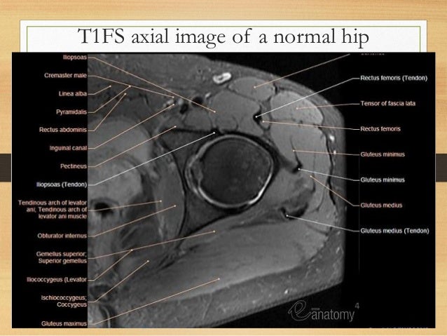 Gluteal region clinical anatomy