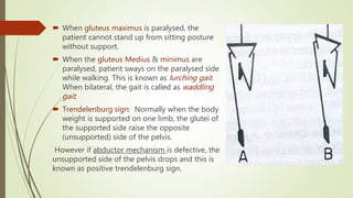 Gluteal region | PPTX