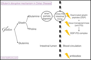 Is Gluten Intolerance real? | PDF