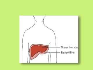 Glycogen by Shivneel Singh | PPT