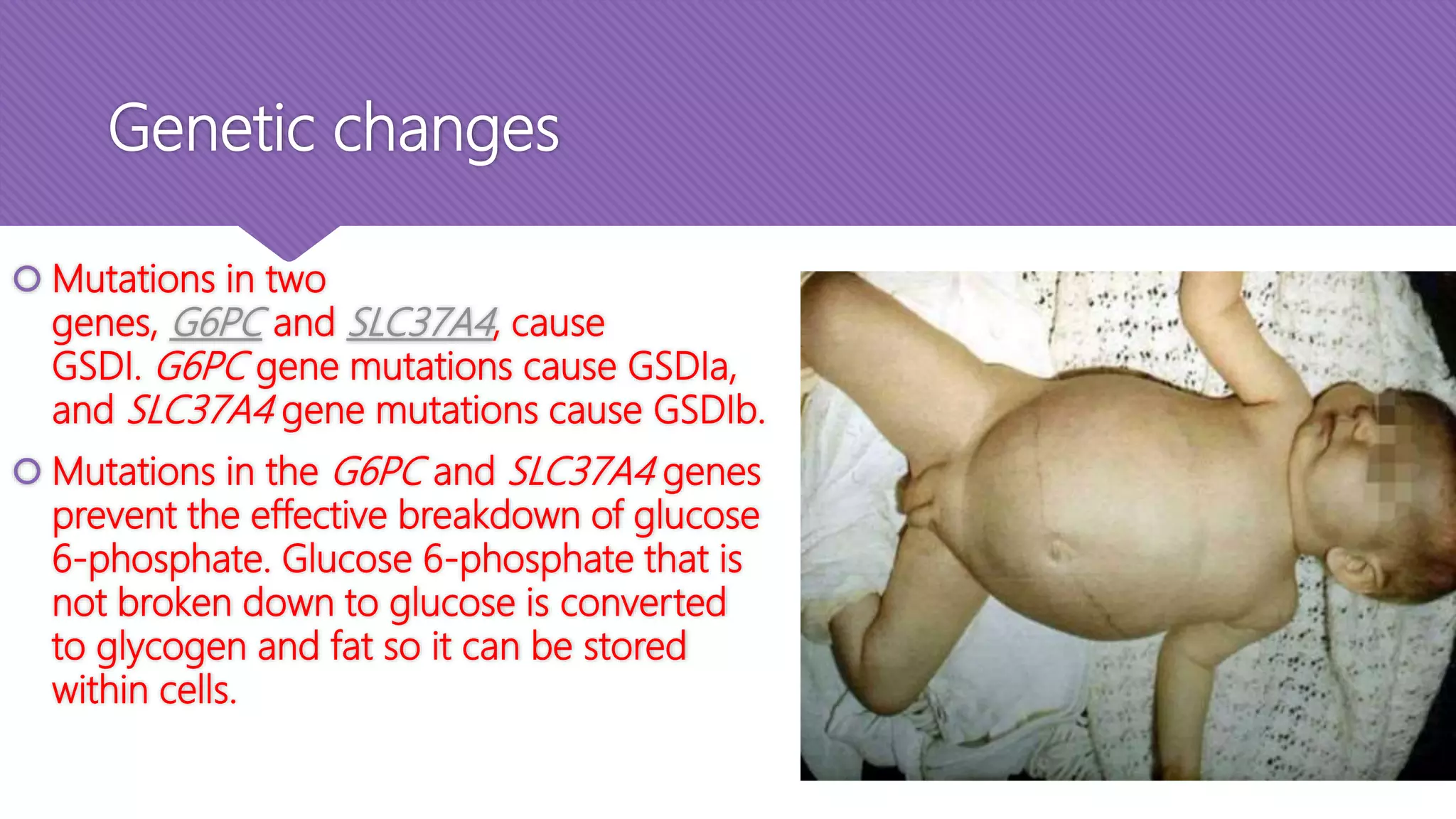 Glycogen storage disorders pathology | PPTX