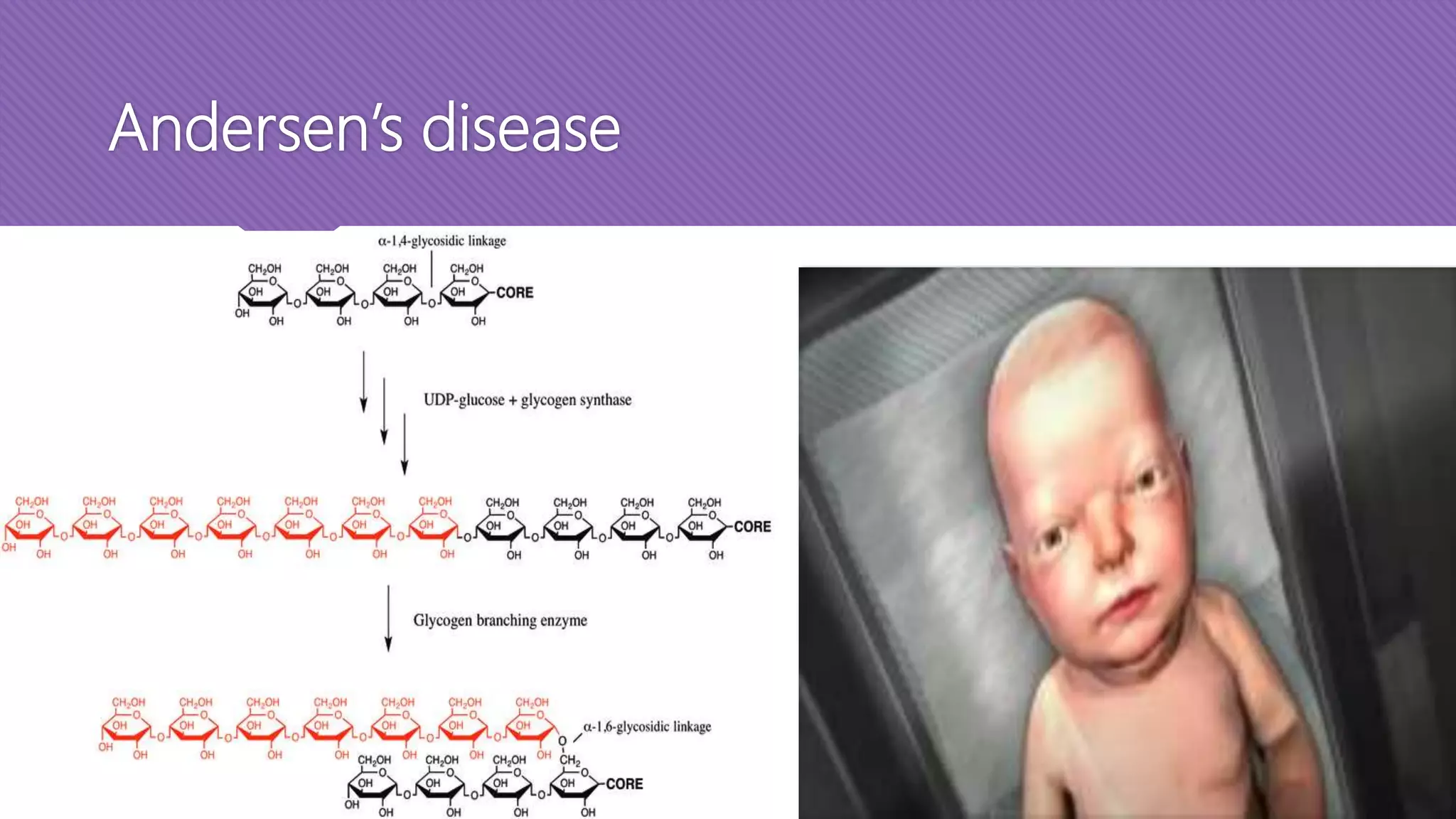 Glycogen storage disorders pathology | PPTX