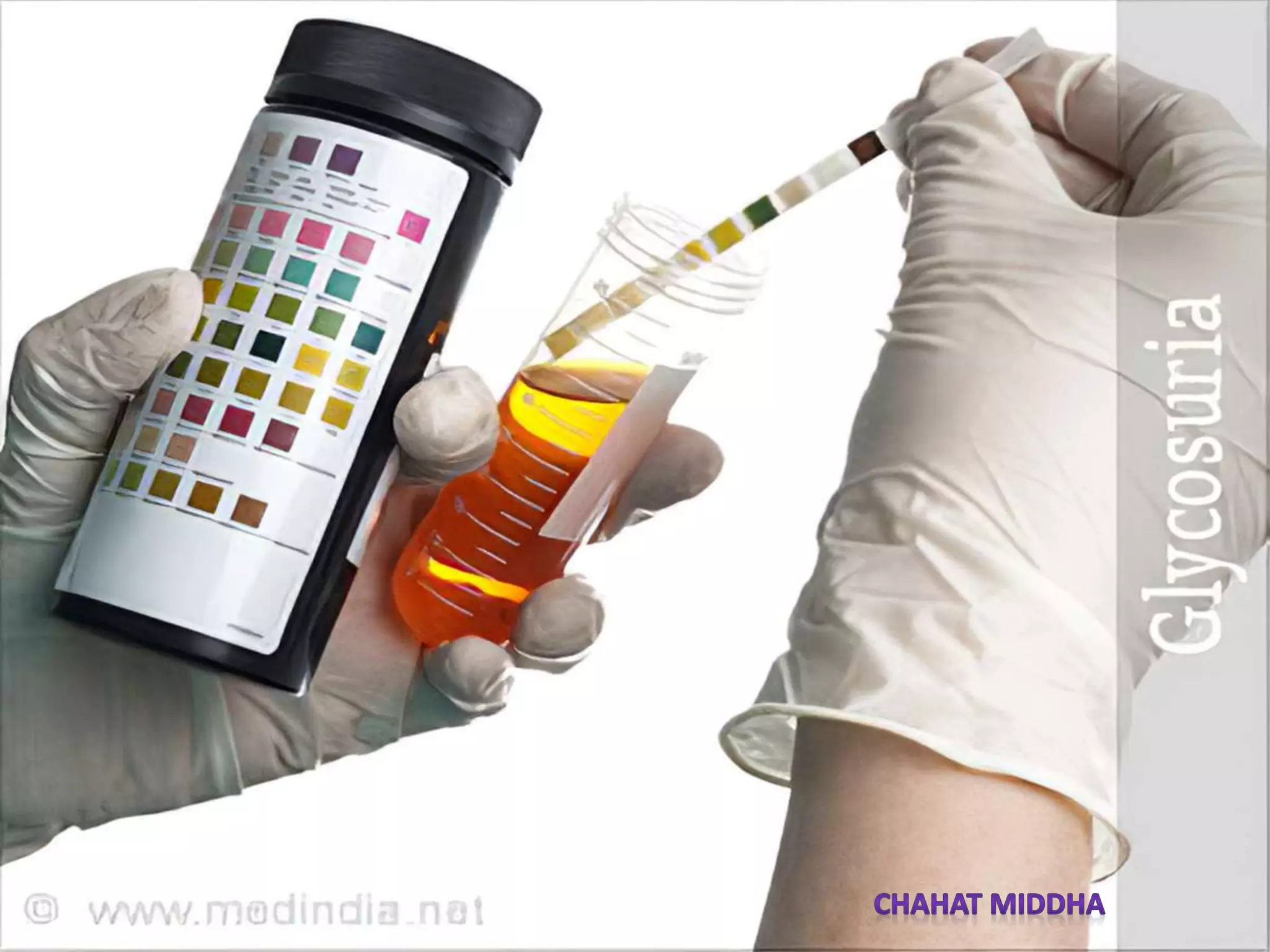 Glycosuria | PPTX | Diabetes | Diseases and Conditions