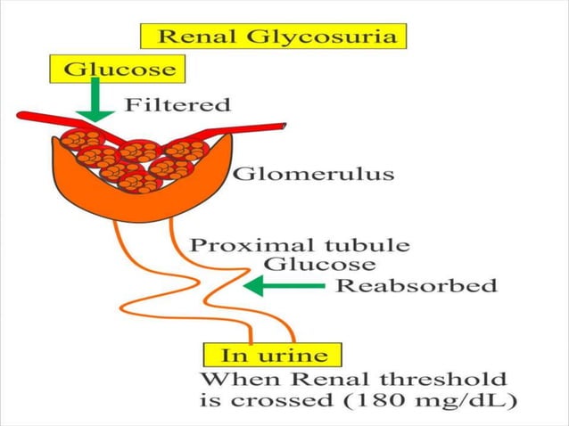 Glycosuria | PPTX | Diabetes | Diseases and Conditions