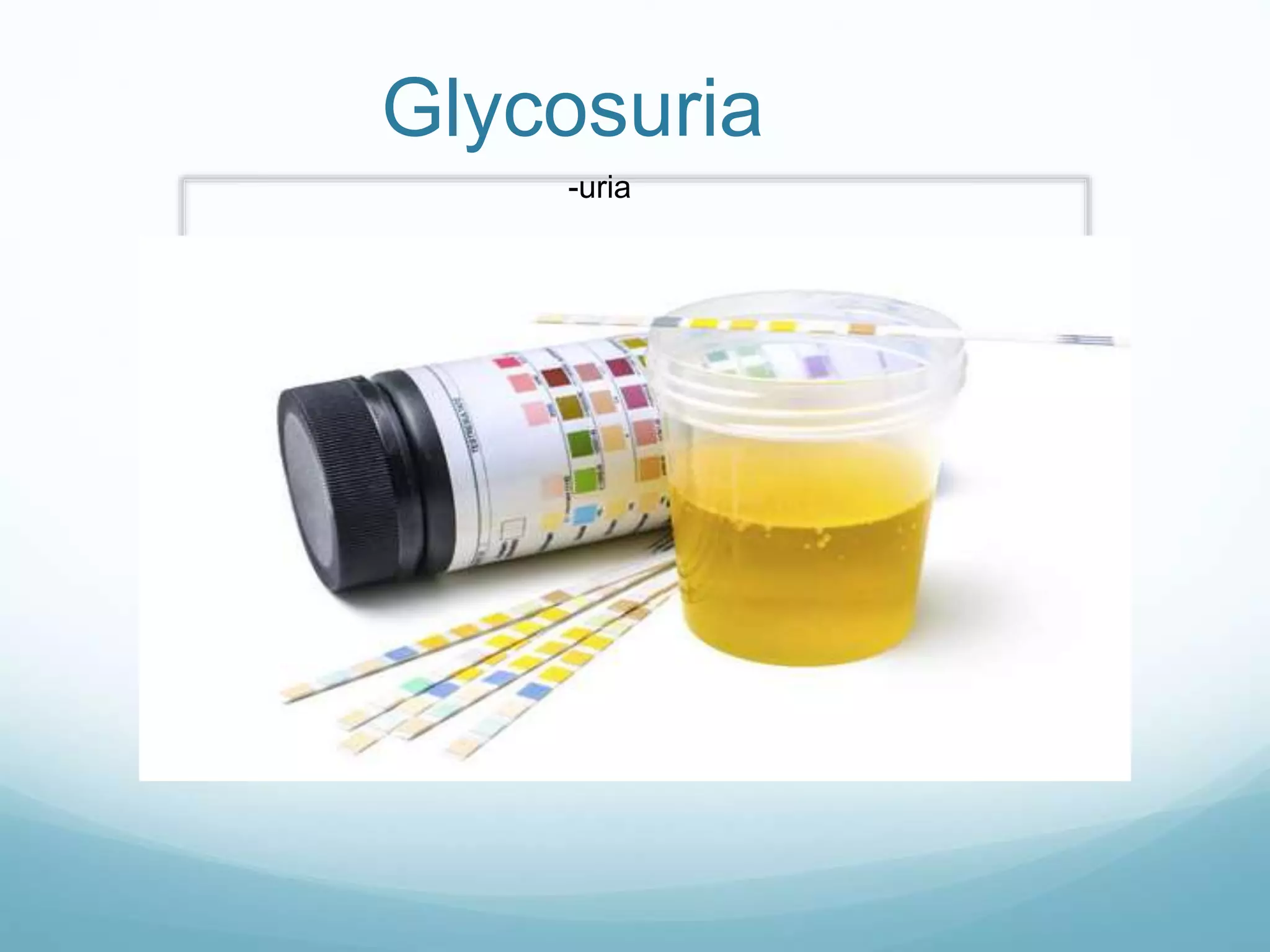 Glycosuria and Polyuria slide show | PPTX