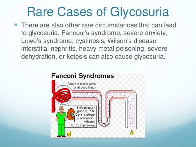 Glycosuria and Polyuria slide show