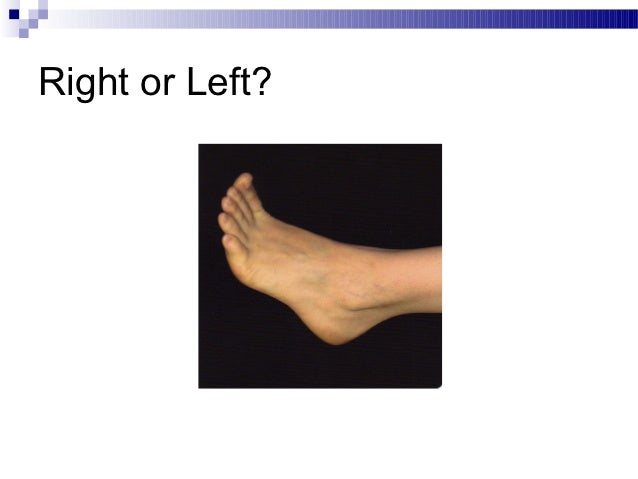 CRPS and Graded Motor Imagery