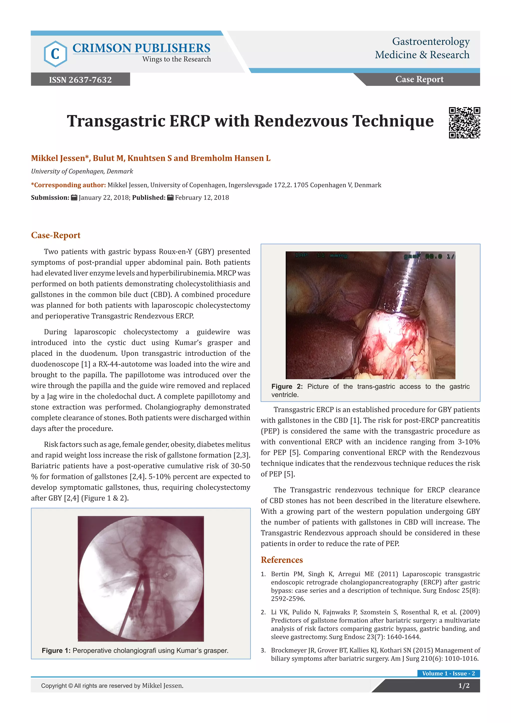 Crimson Publishers: Transgastric ERCP with Rendezvous Technique | PDF