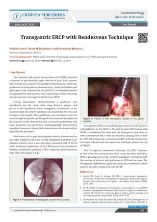 Crimson Publishers: Transgastric ERCP with Rendezvous Technique | PDF