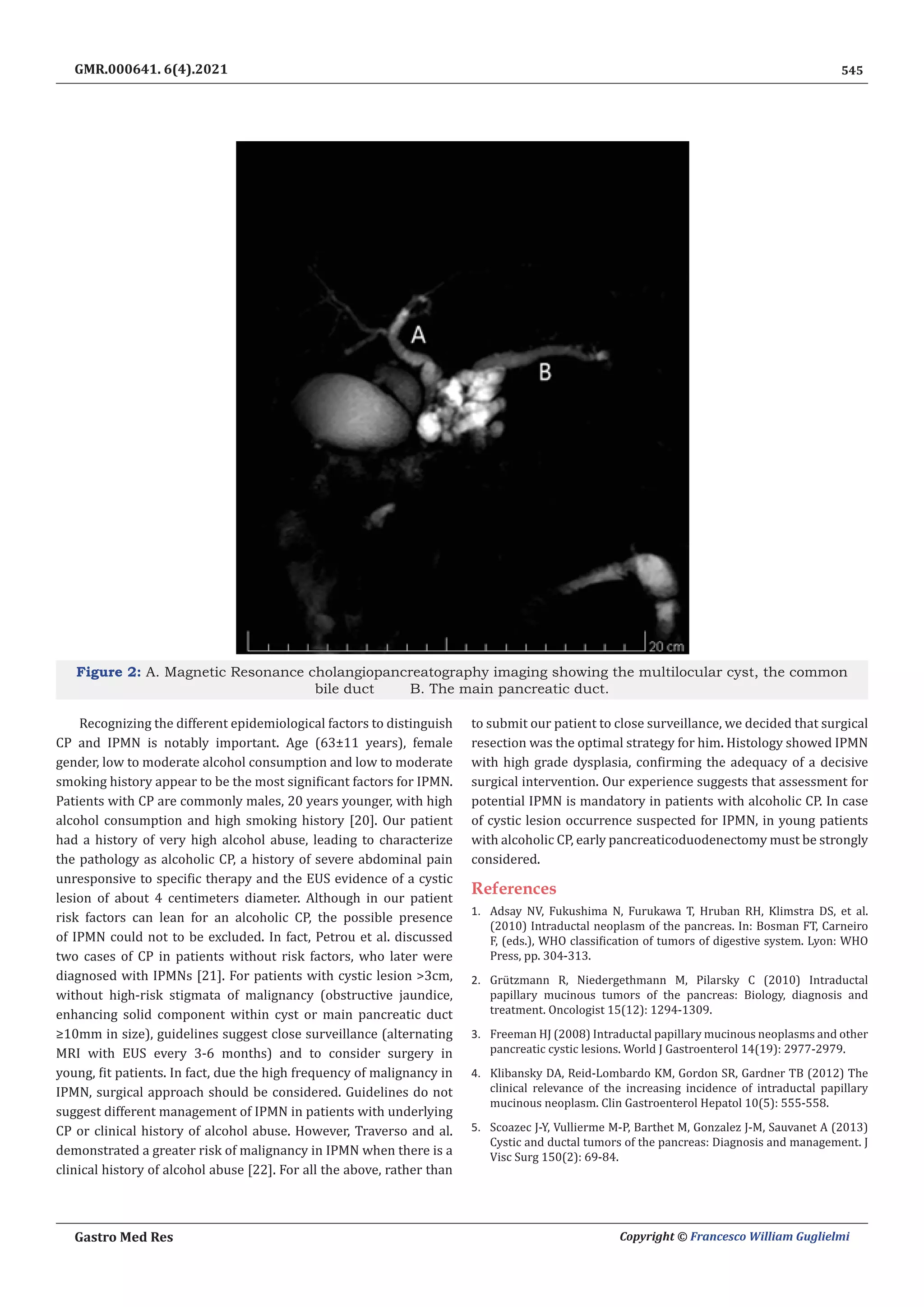 Alcoholic Chronic Pancreatitis or Intraductal Papillary Mucinous ...
