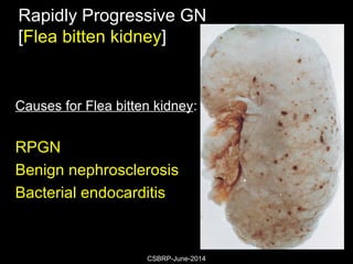 Flea Bitten Kidney