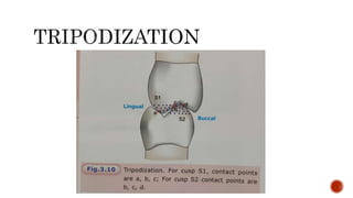GNATHOLOGICAL CONCEPTS OF RESTORATION.pptx
