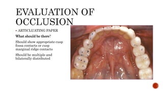 GNATHOLOGICAL CONCEPTS OF RESTORATION.pptx