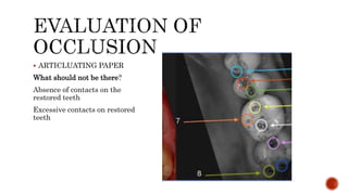GNATHOLOGICAL CONCEPTS OF RESTORATION.pptx