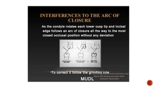 GNATHOLOGICAL CONCEPTS OF RESTORATION.pptx