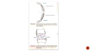 GNATHOLOGICAL CONCEPTS OF RESTORATION.pptx