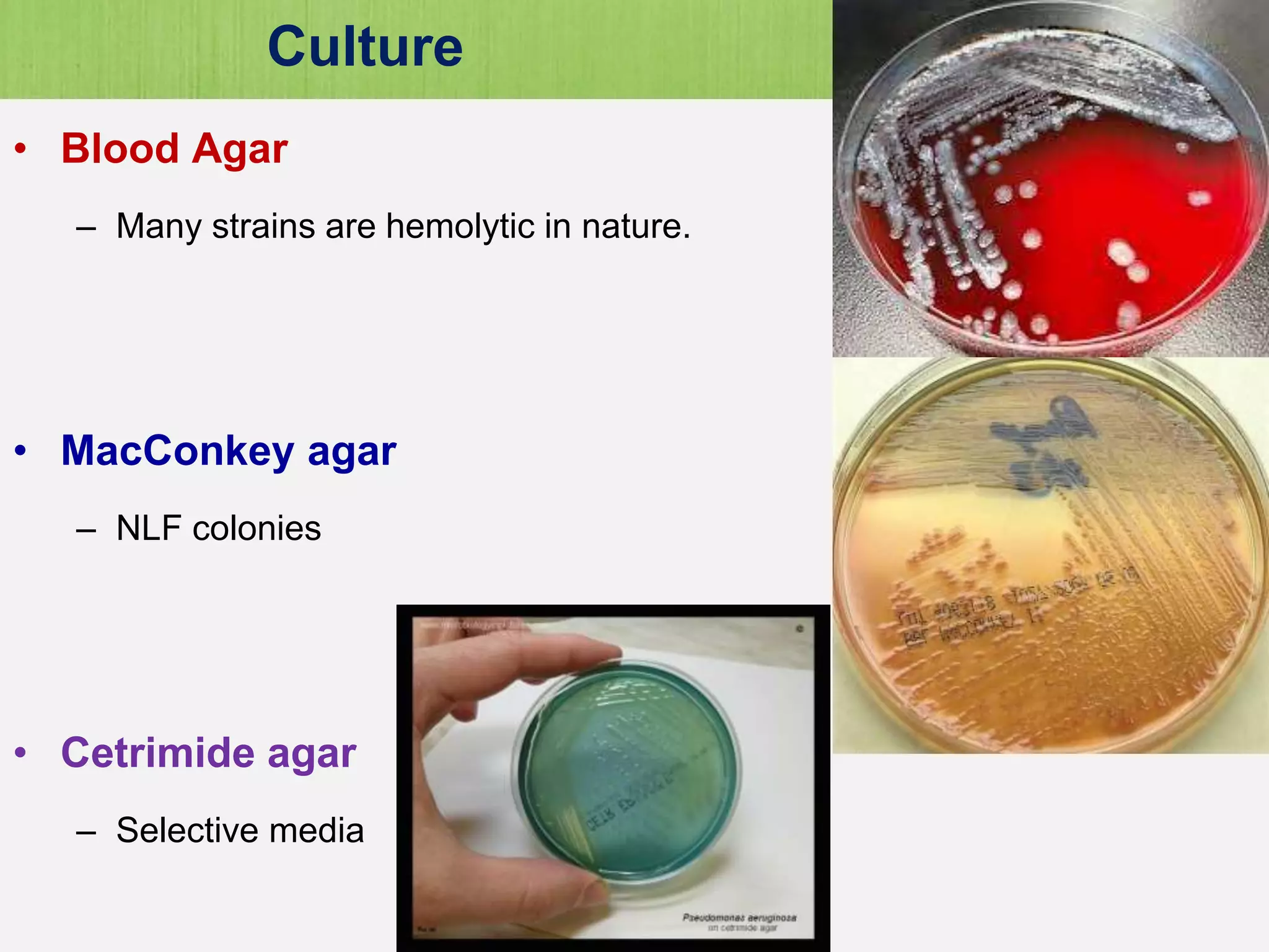 GNNF (Pseudomonas and Acinetobacter).ppt
